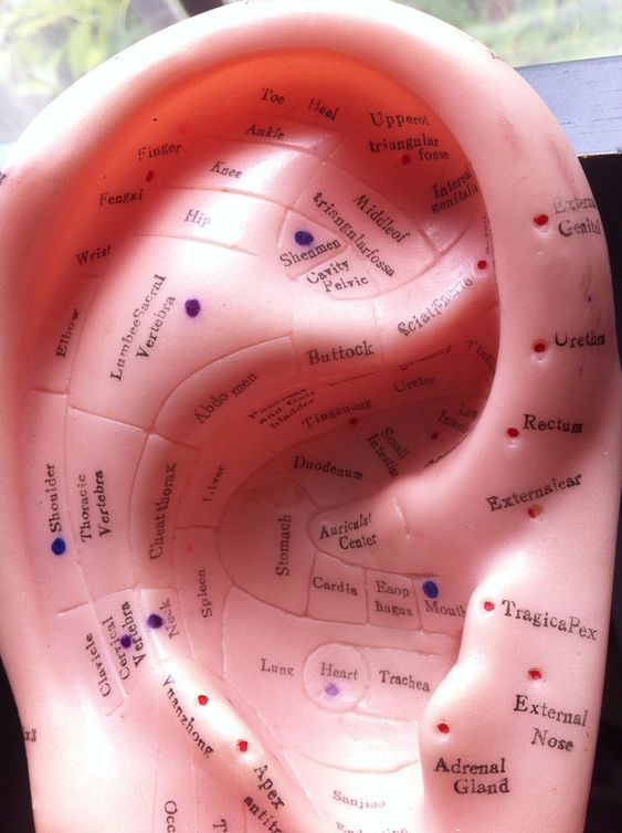 Port Moody Soliman Auricular Allergy Treatment - Mountain Vista Health ...